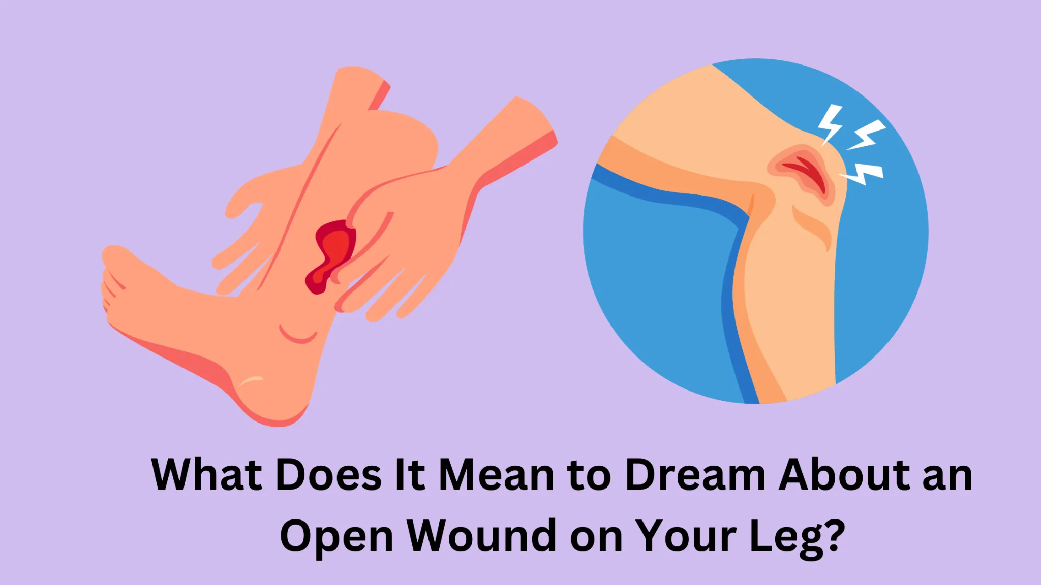 What Does It Mean To Dream About An Open Wound On Your Leg? - Dream Archive